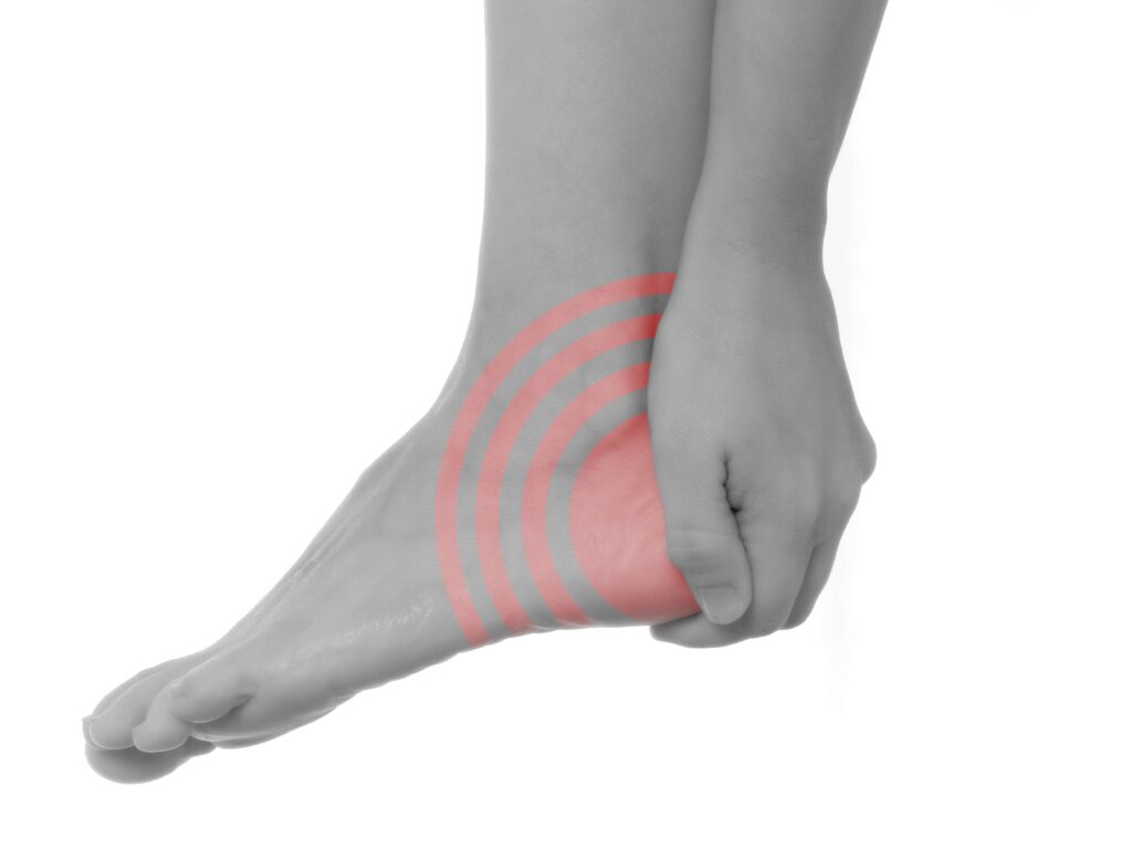 Haglund’s Deformity | Richardson Podiatry Center